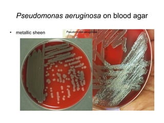 Campy Blood Agar