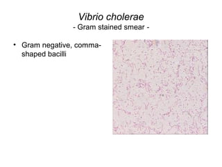 Vibrio Cholerae Gram Stain