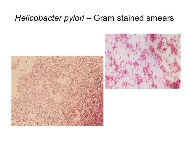 Vibrio campylobacter helicobacter_pseudomonas