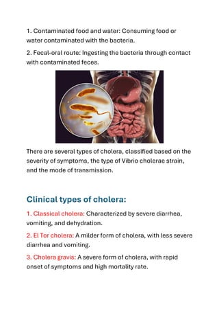 vibrio cholera , Clinical types of cholera , | PDF