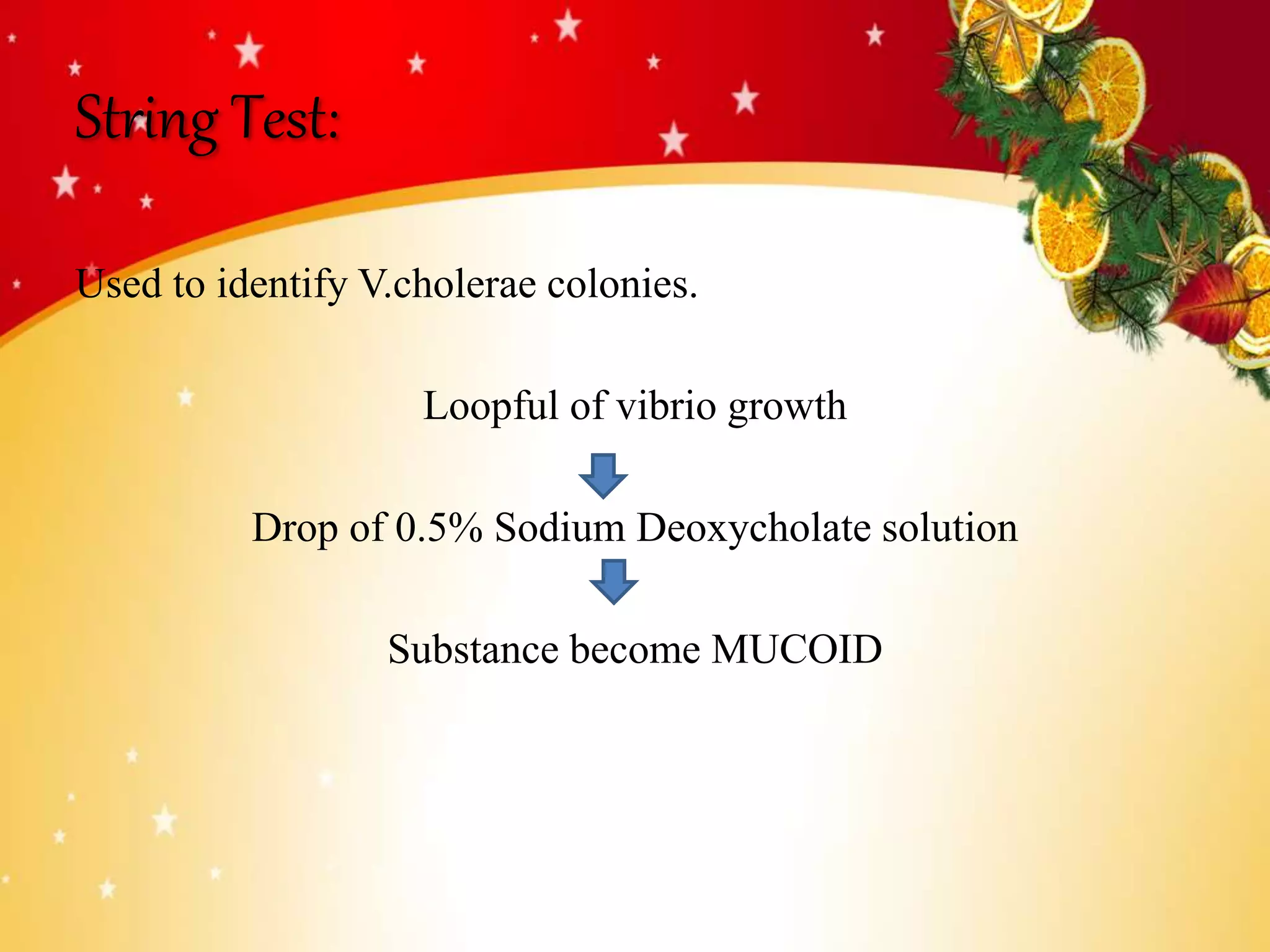 Vibrio cholerae PPT for students | PPTX