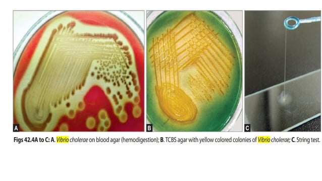 Vibrio cholera, Pathogenesis, Mode of transmission, symptoms and ...