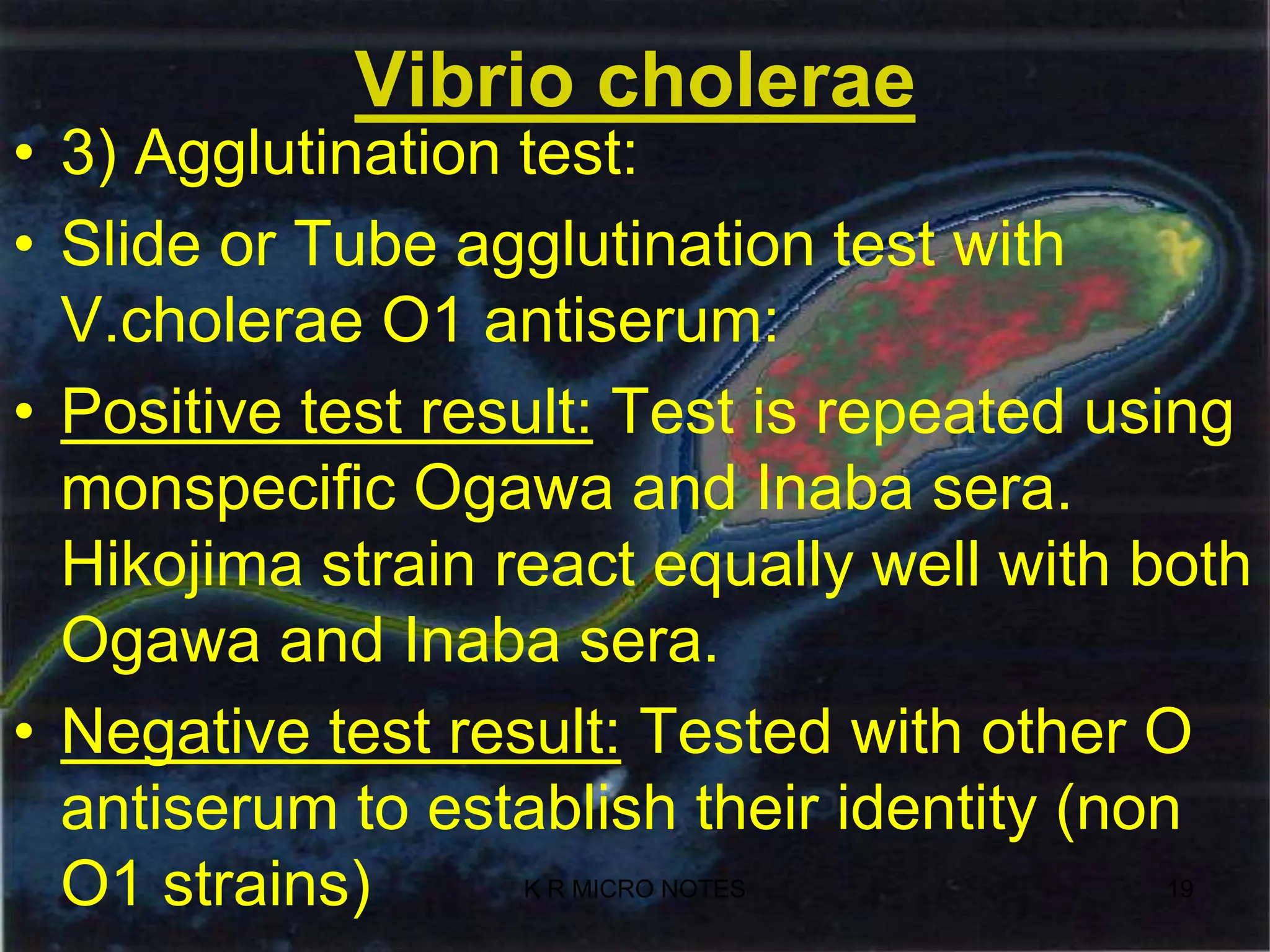 Vibrio Cholera .ppt