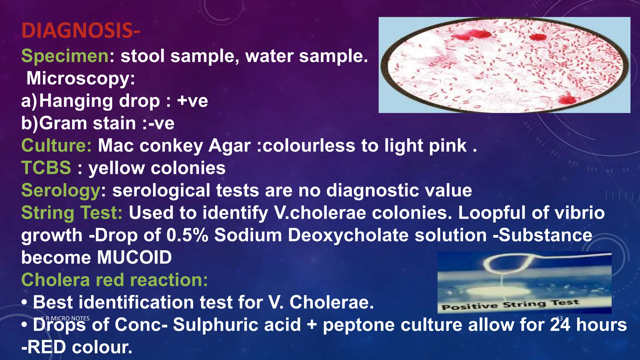 Vibrio cholera .pptx