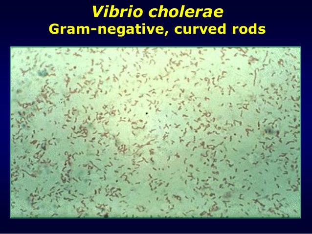 Vibrio mahadi ppt