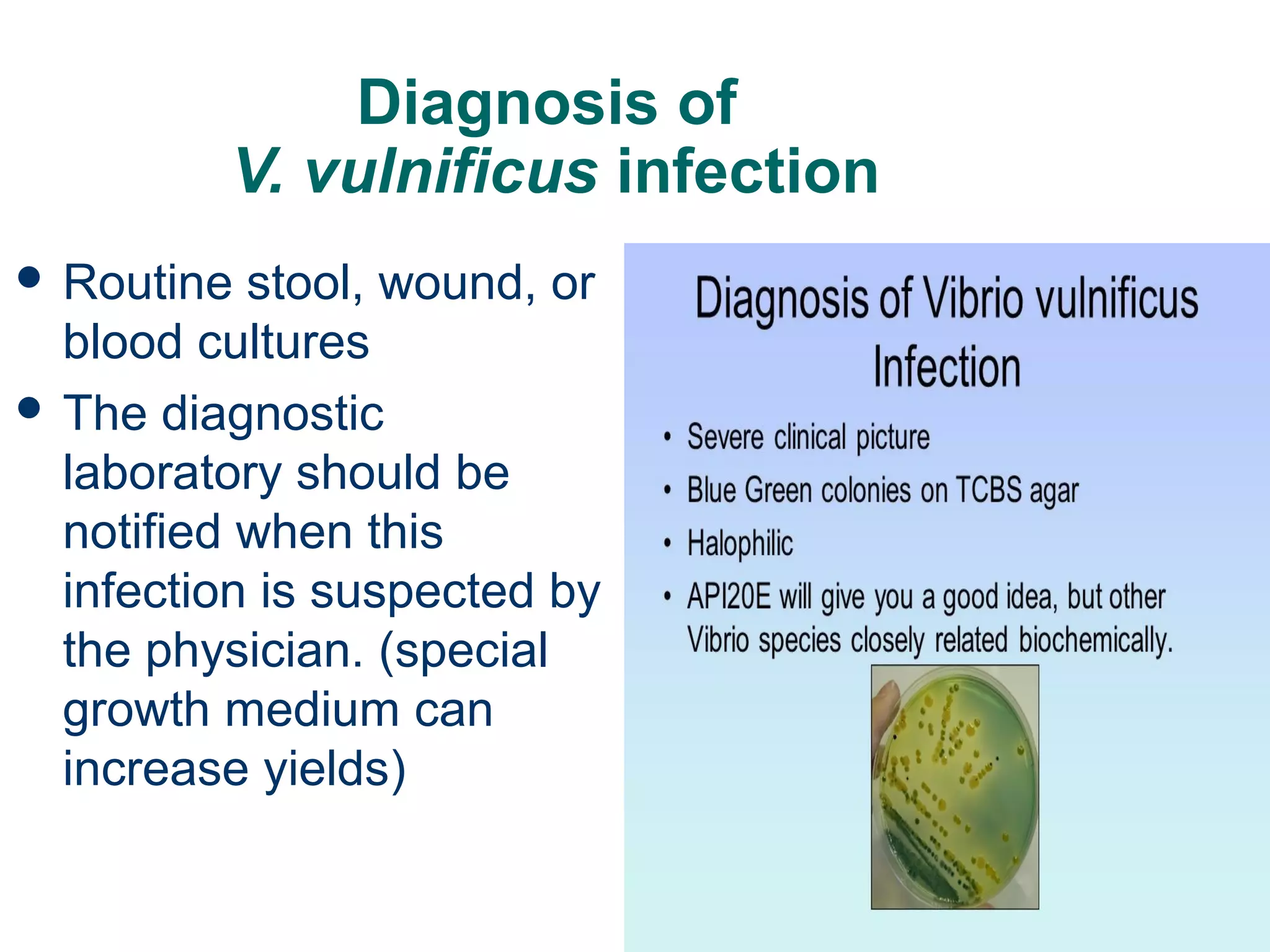 Vibrio vulnificus | PPT