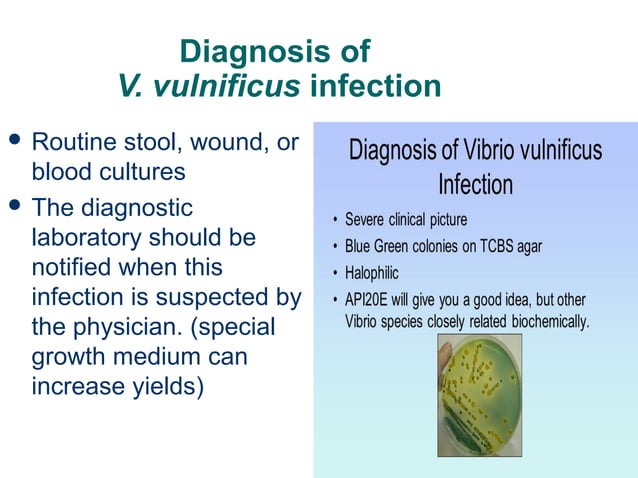 Vibrio vulnificus | PPT