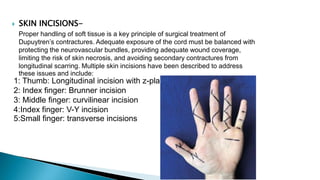 Dupuytren disease | PPTX