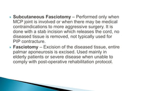 Dupuytren disease | PPTX