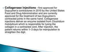 Dupuytren disease | PPTX