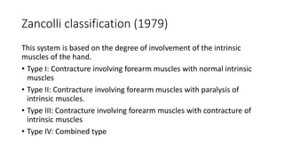Volksman ischemic Contracture orthopaedics .pptx