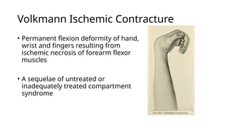 Volkmann Ischemic Cotracture introd.pptx