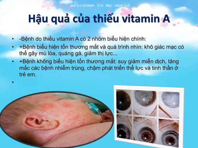 Vi chất dinh dưỡng nhóm 11 | PPTX