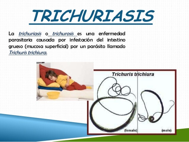 Trichuriasis - Pictures