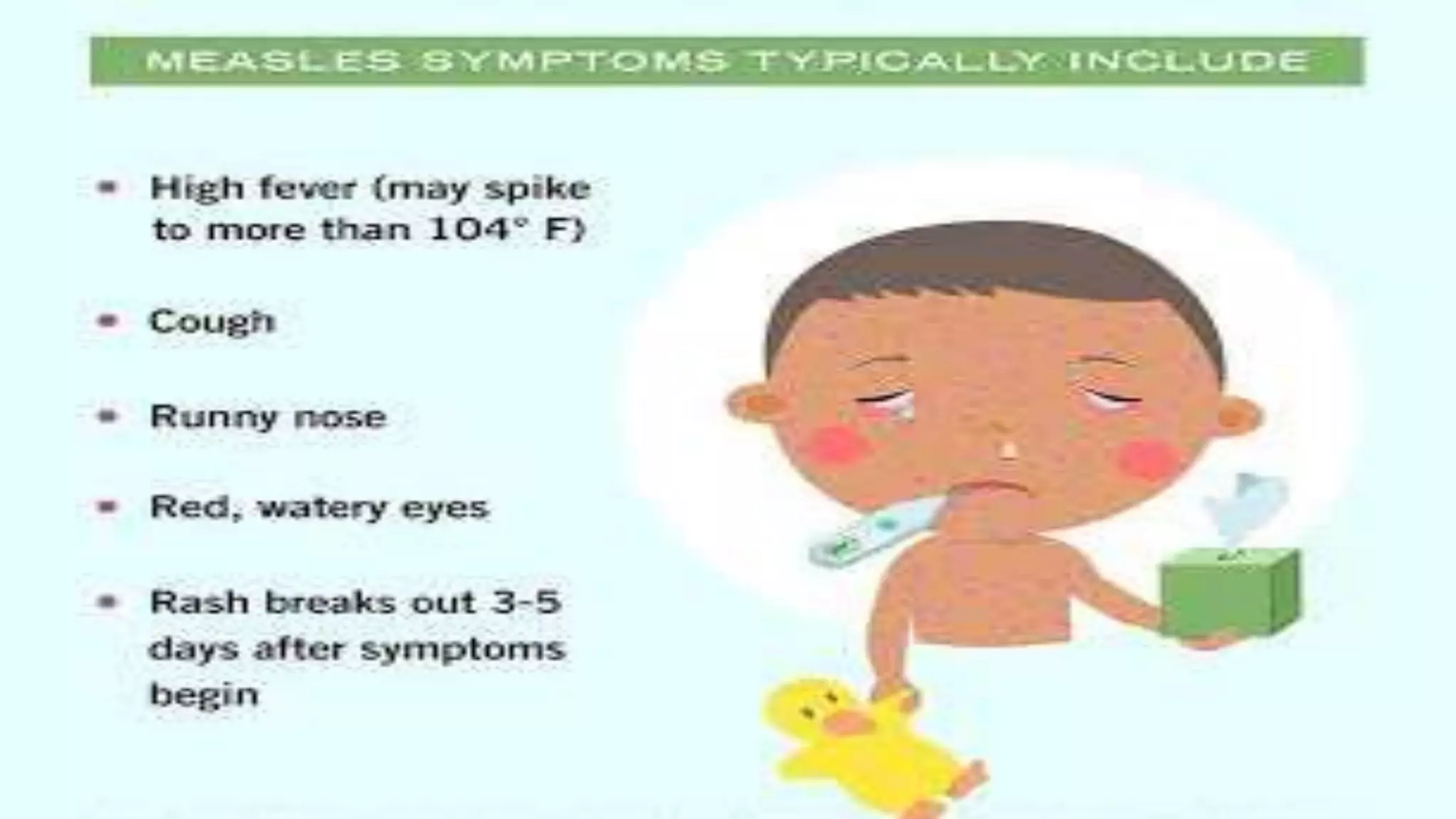 Measles and the eye.pptx