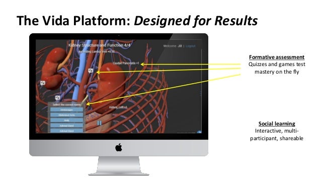 Vida systems january 2015.public