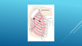Video-assisted thoracic surgery (VATS).pptx