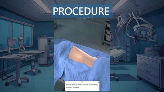 Video-assisted thoracic surgery (VATS).pptx