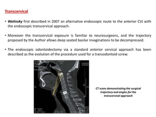 Video assissted anterior approaches to cvj | PPT