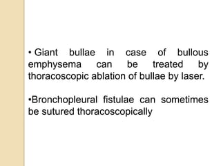 Video assisted thoracic surgery | PPTX