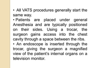 Video assisted thoracic surgery | PPTX