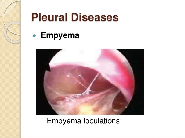 Video assisted thoracic surgery