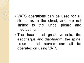 Video assisted thoracic surgery (VATS) seminar | PPTX