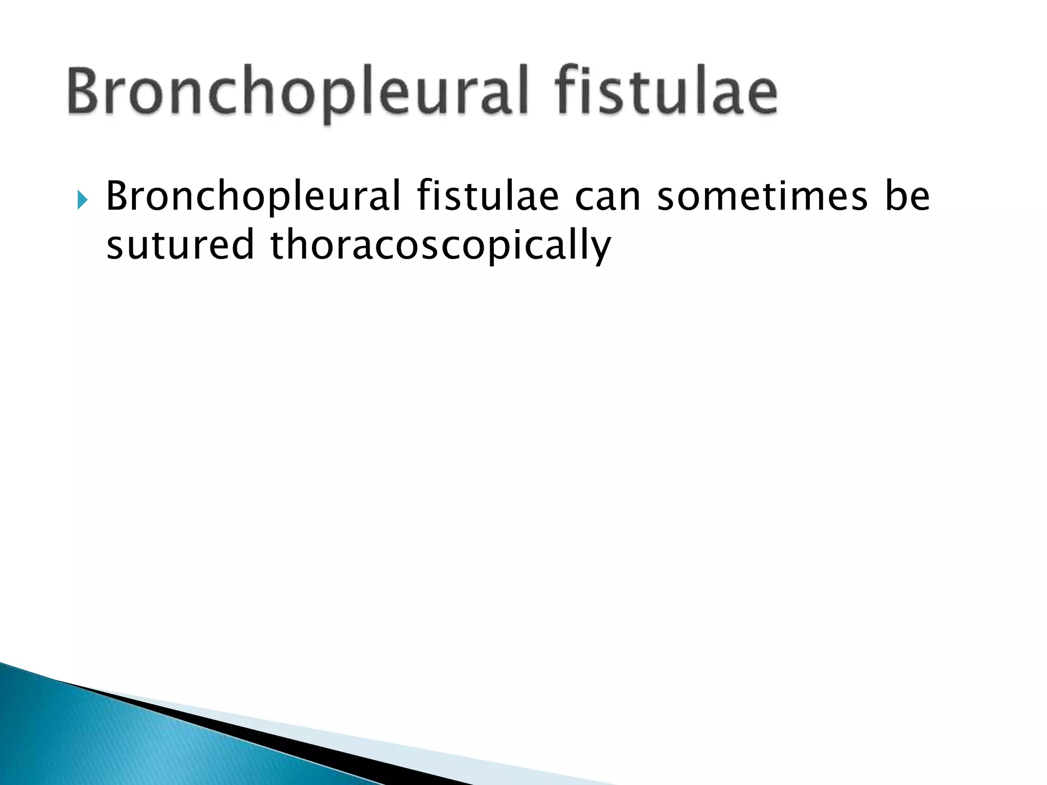 Video assisted thoracic surgery (vats) | PPTX