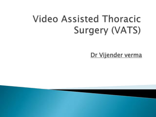 Video assisted thoracic surgery (vats) | PPTX