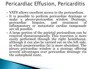Video assisted thoracic surgery (vats) | PPTX
