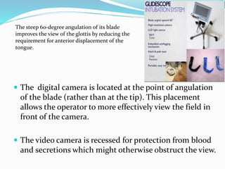 Video & fibreoptic laryngoscope | PPTX