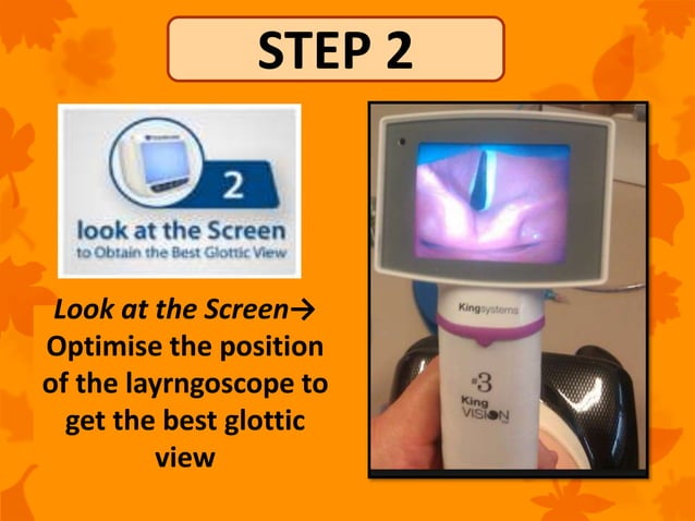 Videolaryngoscopes for tracheal intubation | PPTX | Ear, Nose and ...