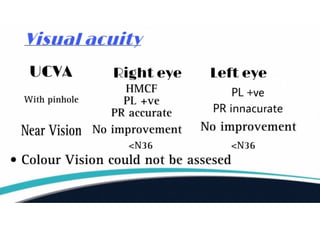 CASE SHEET of patient having RRD , CATARACT | PPT