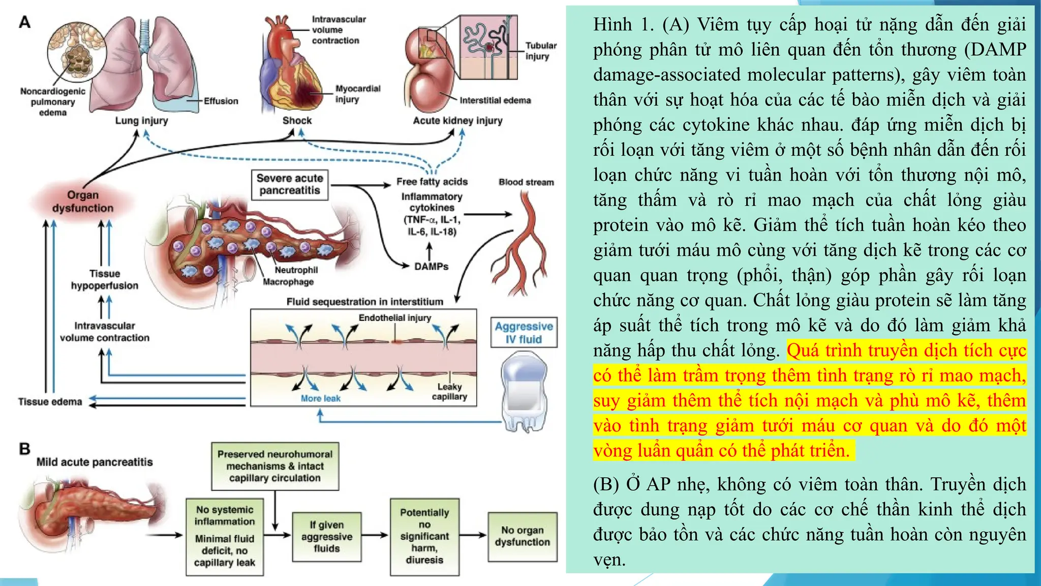 Viêm tụy cấp 2022 - C.pptxhghvhnjkkkkkk | PPT