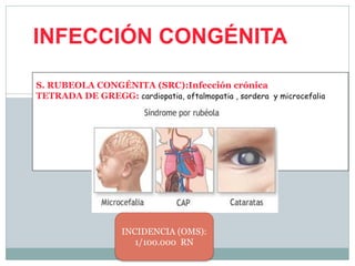 Viernes 4 infecciones del grupo torch y embarazo | PDF