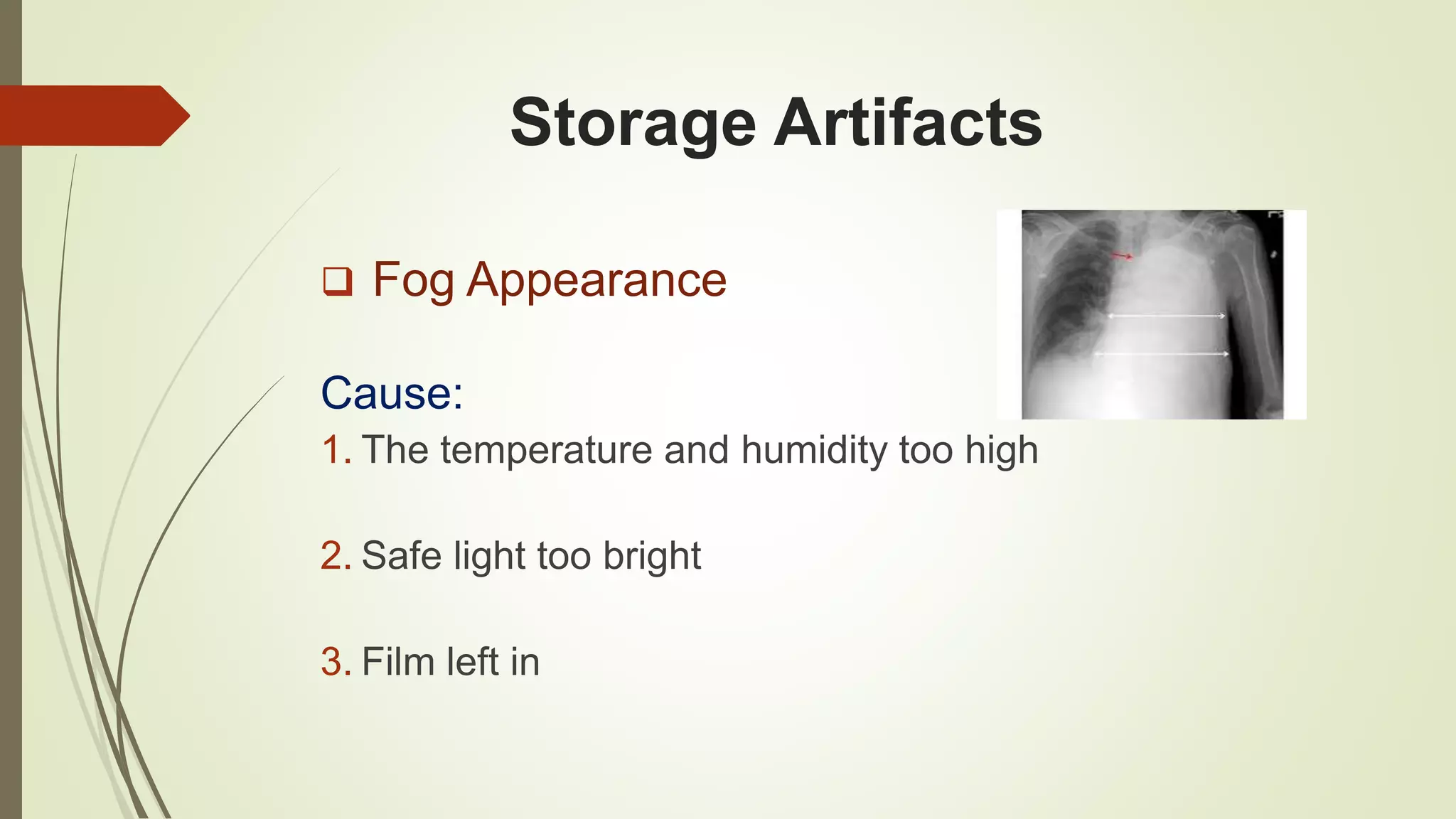 Viewing and storage of x ray film | PPTX