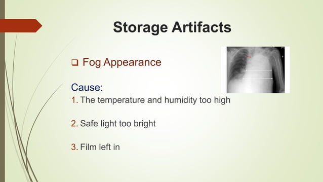 Viewing and storage of x ray film | PPTX | Cameras and Camcorders ...