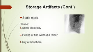 Viewing and storage of x ray film | PPTX