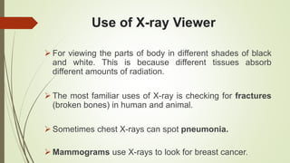 Viewing and storage of x ray film | PPTX