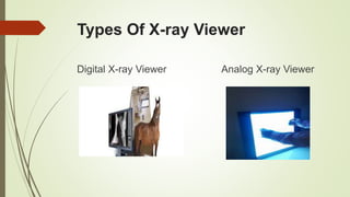 Viewing and storage of x ray film | PPTX