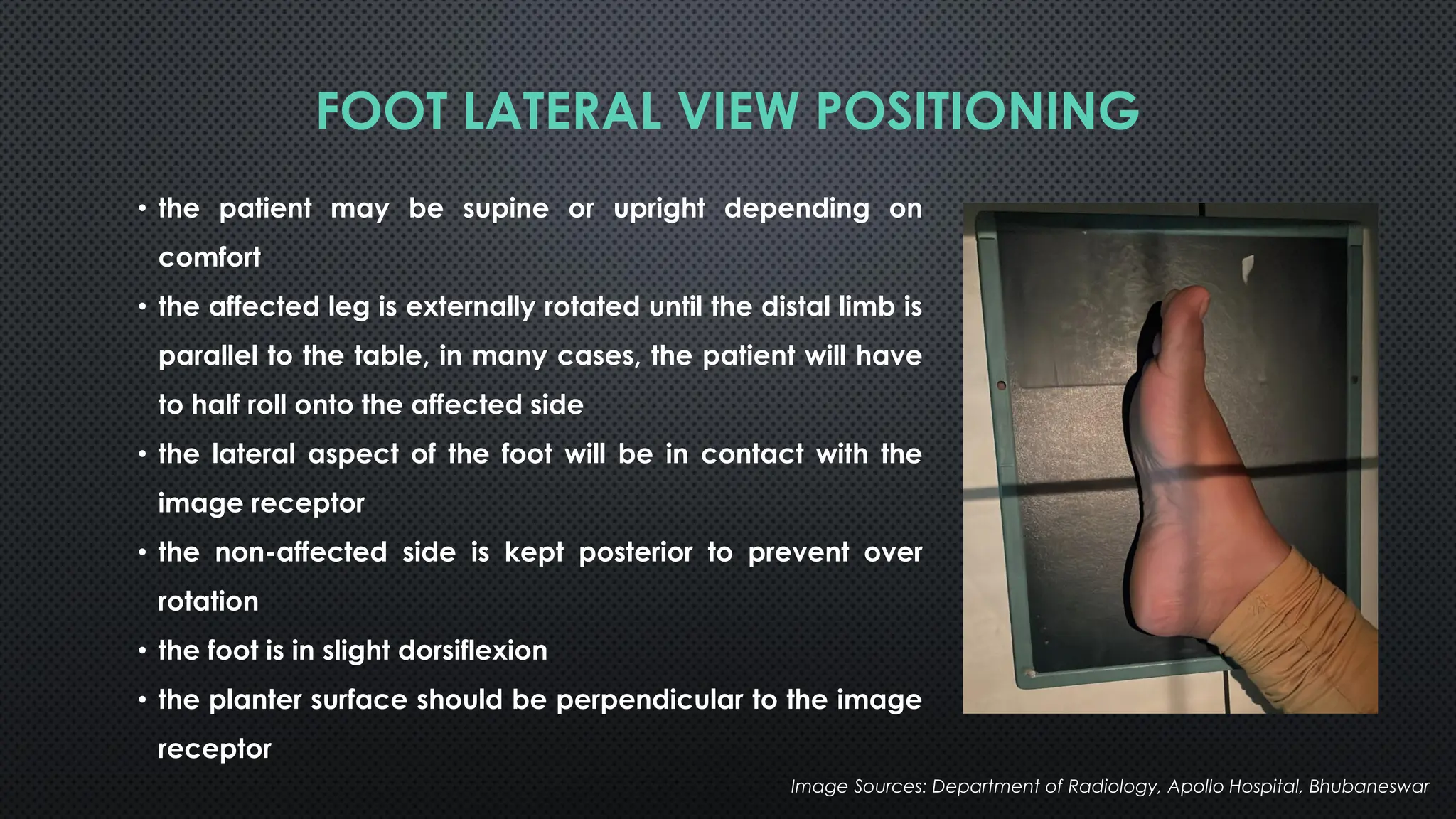 X-RAY views for foot, calcaneum, and ankle joint. | PDF