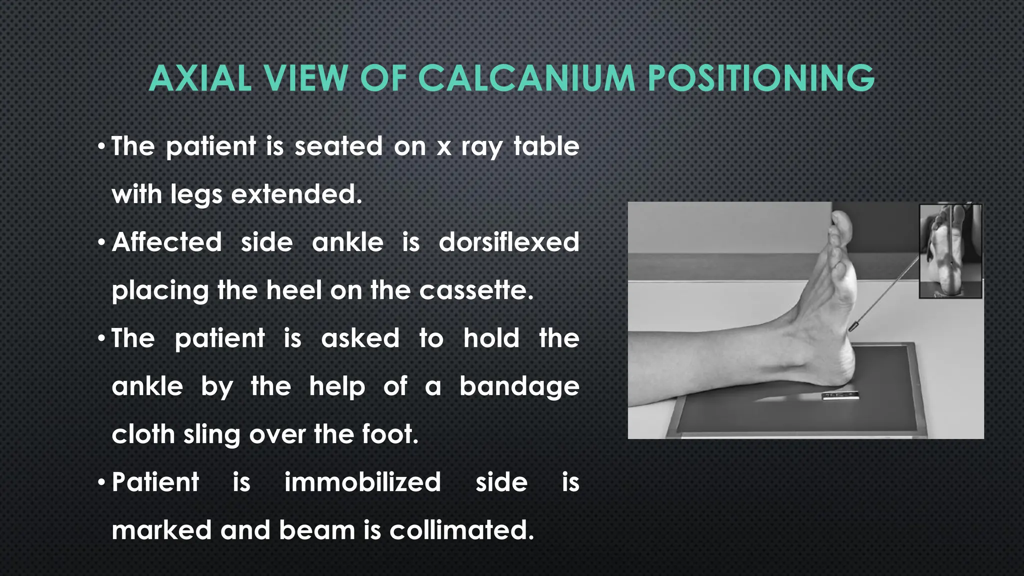 X-RAY views for foot, calcaneum, and ankle joint. | PDF