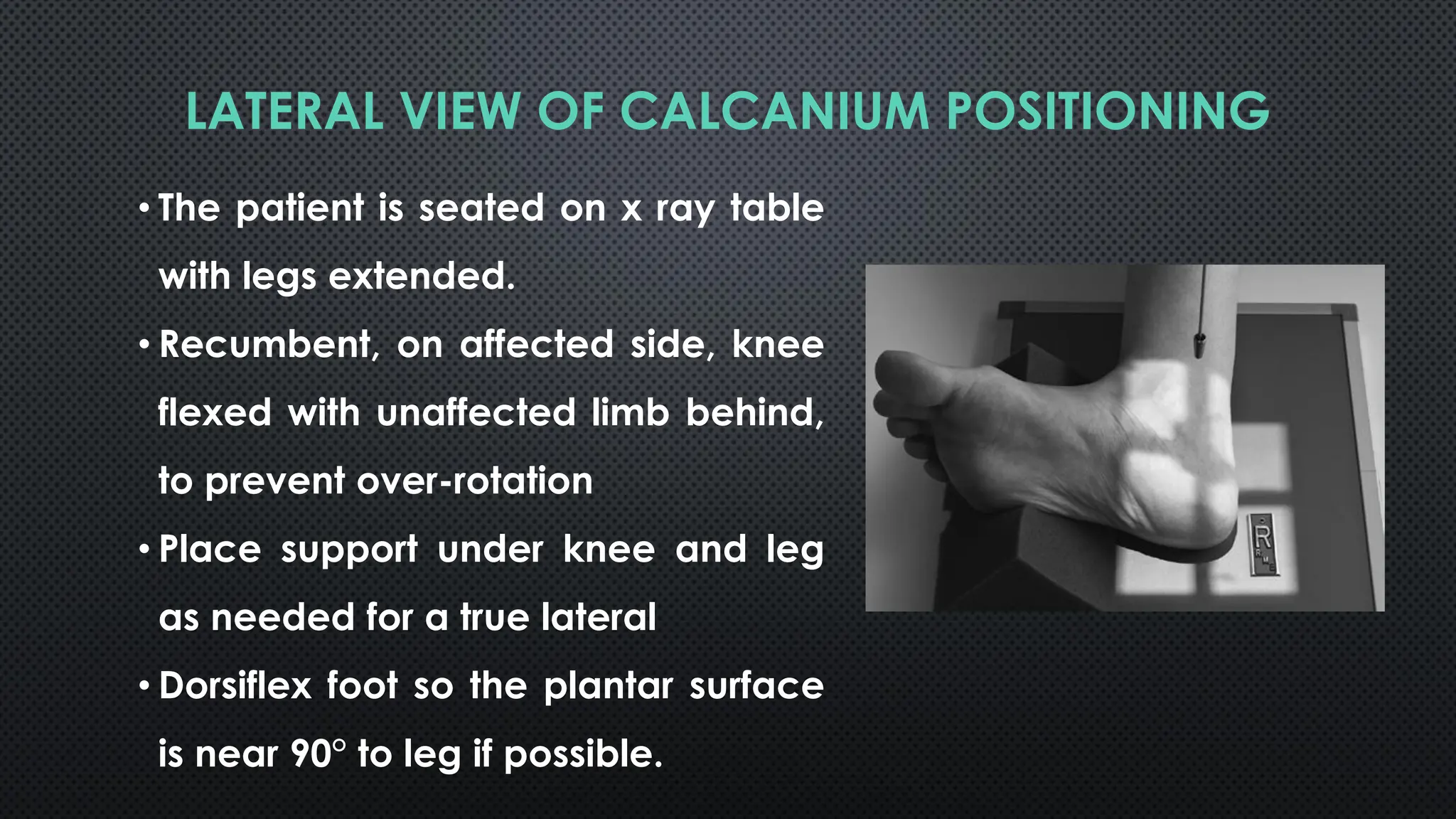 X-RAY views for foot, calcaneum, and ankle joint. | PDF