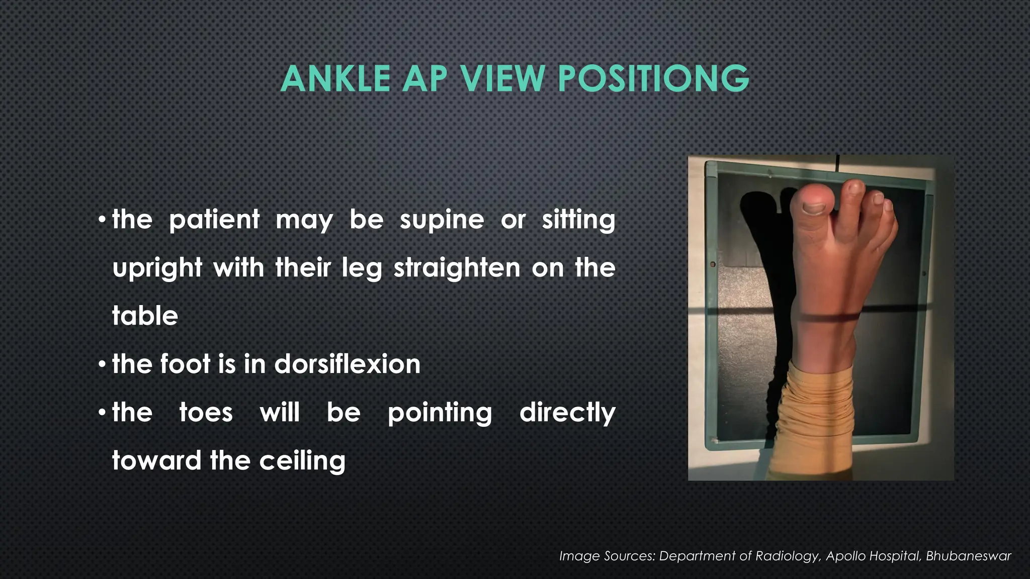 X-RAY views for foot, calcaneum, and ankle joint. | PDF