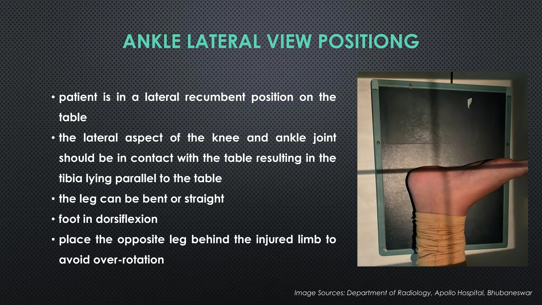 X-RAY views for foot, calcaneum, and ankle joint. | PDF