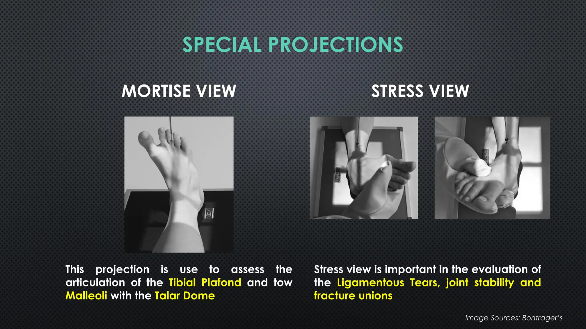 X-RAY views for foot, calcaneum, and ankle joint. | PDF