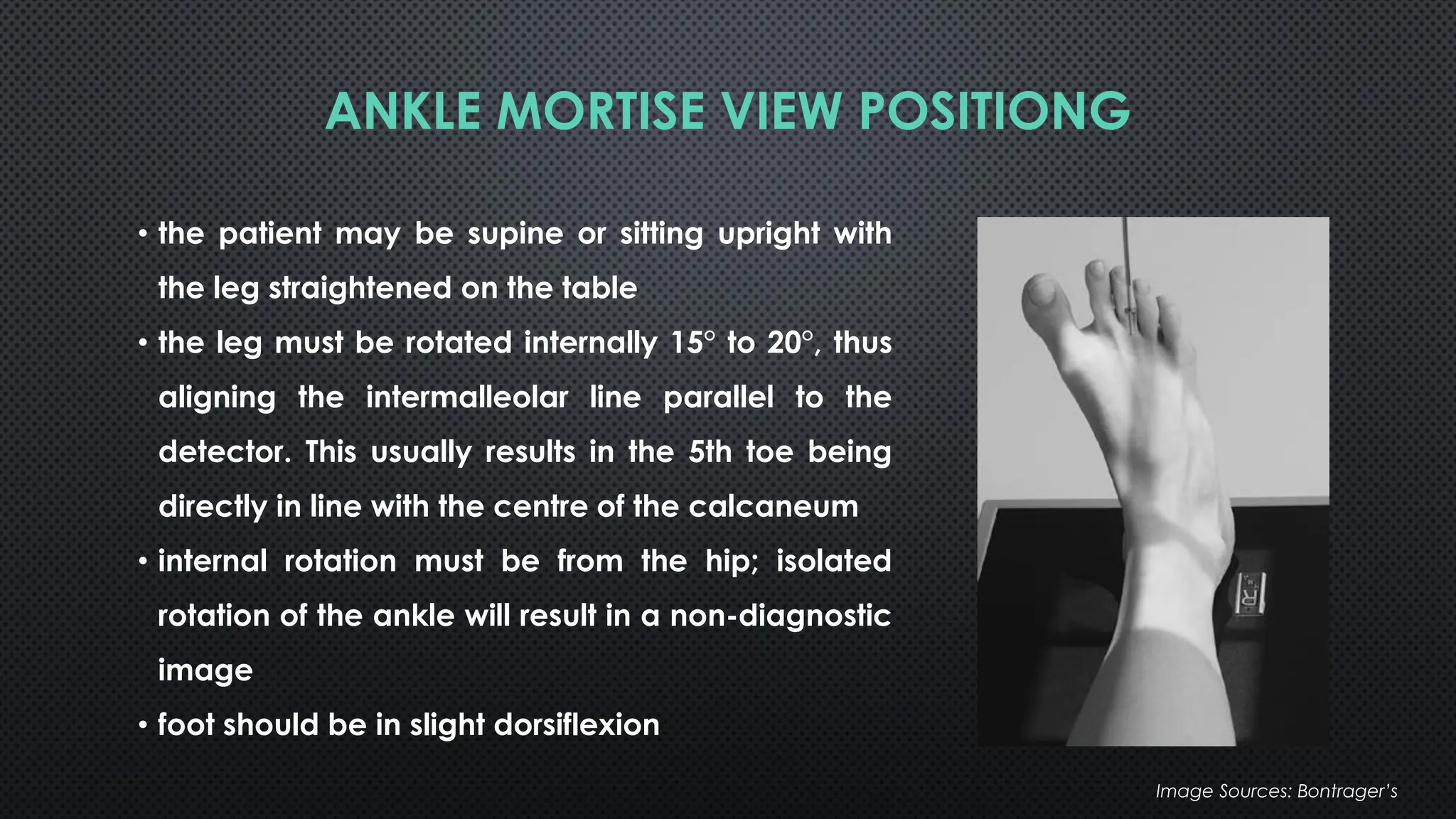 X-RAY views for foot, calcaneum, and ankle joint. | PDF
