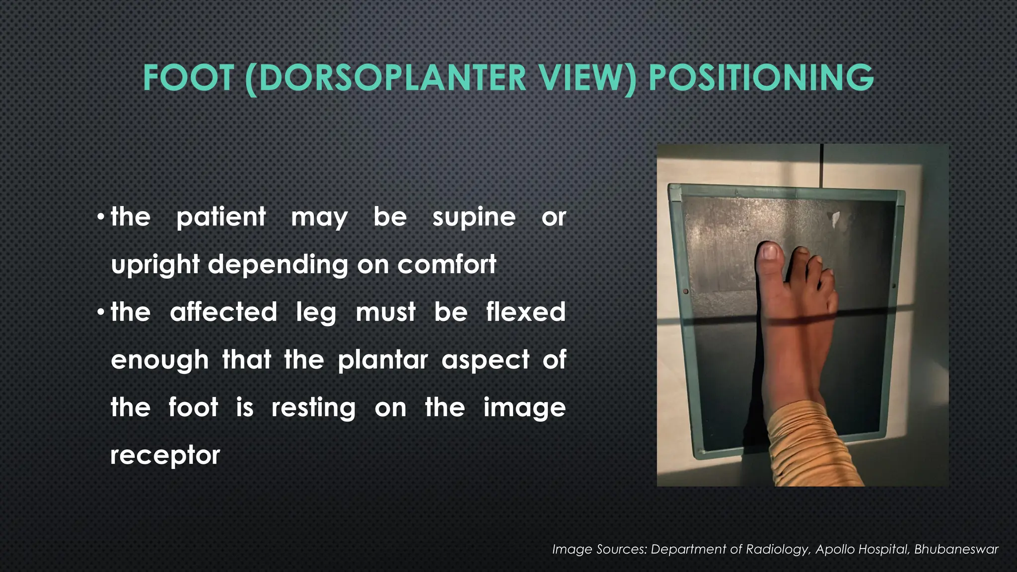 X-RAY views for foot, calcaneum, and ankle joint. | PDF