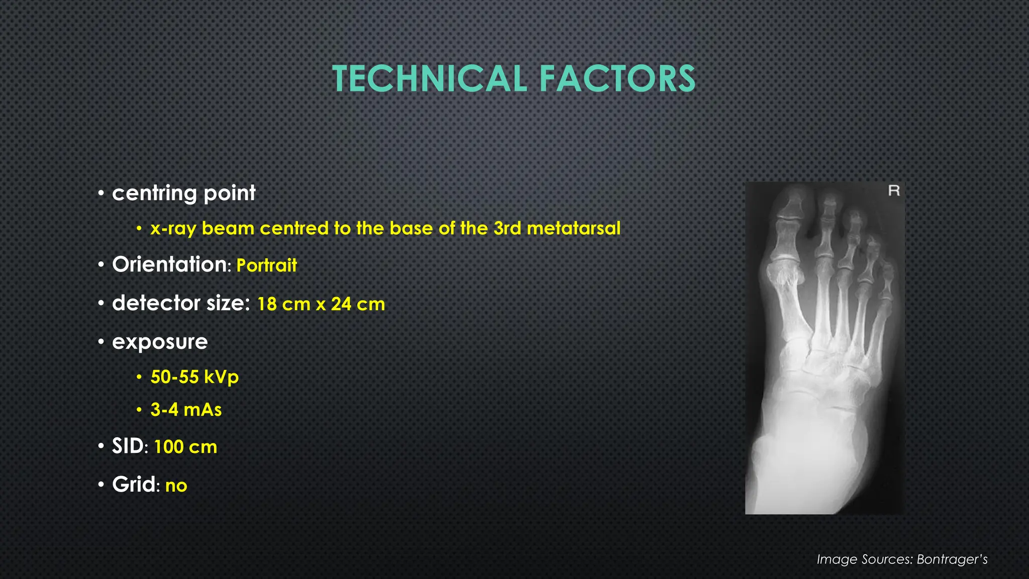 X-RAY views for foot, calcaneum, and ankle joint. | PDF
