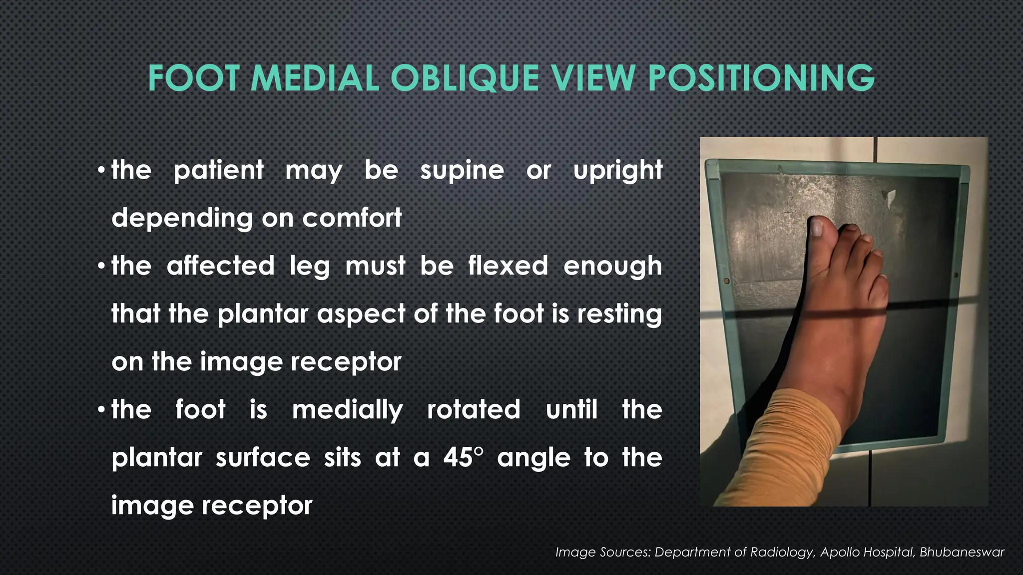 X-RAY views for foot, calcaneum, and ankle joint. | PDF